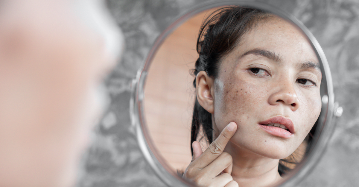 Quels sont les effets néfastes du stress sur la peau ? - ELLE.be